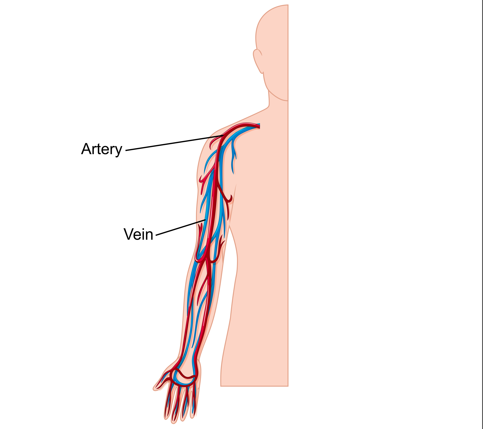 Arteriovenous fistula - Treatians