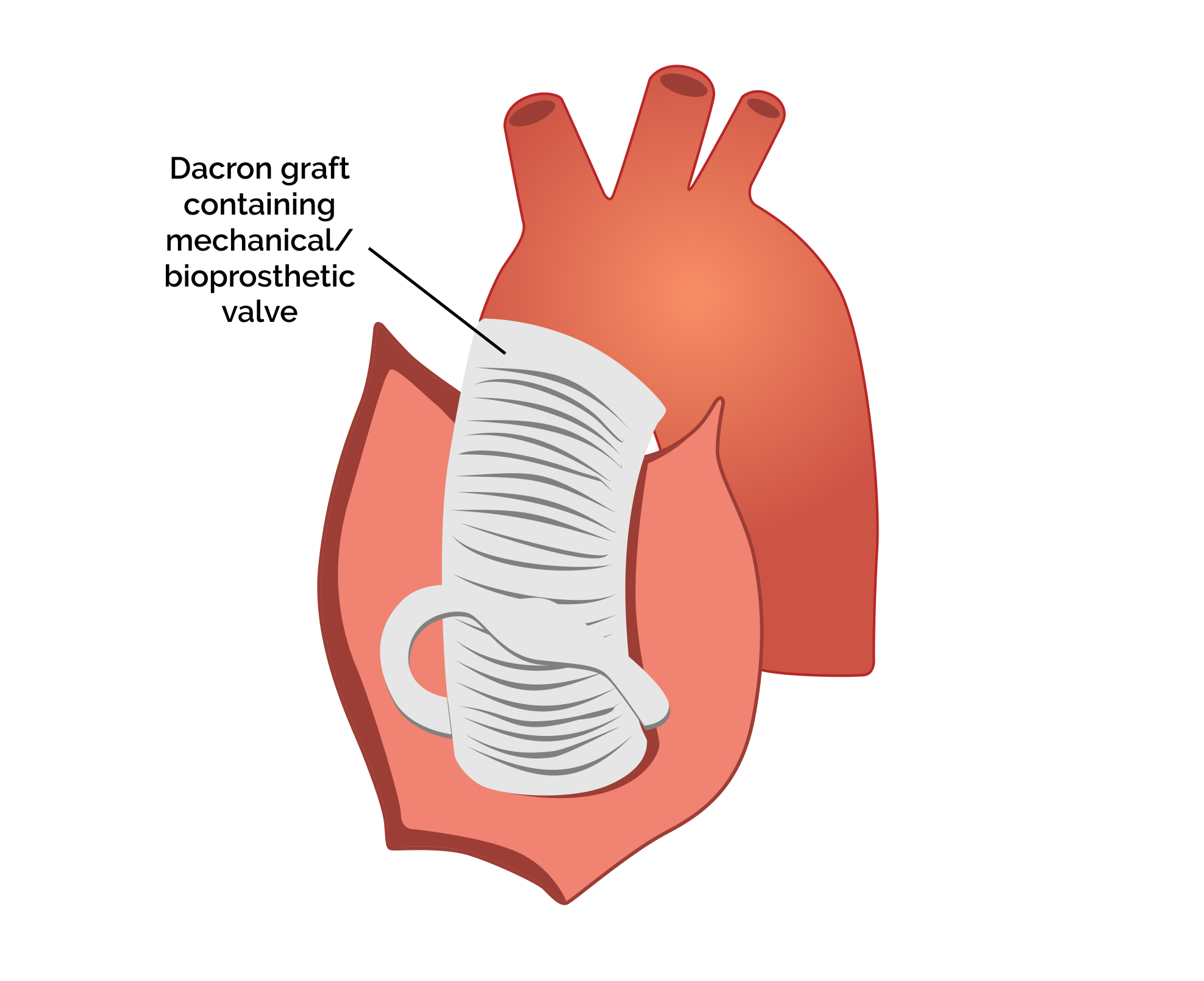 Comprehensive Bental Operation at Treatians