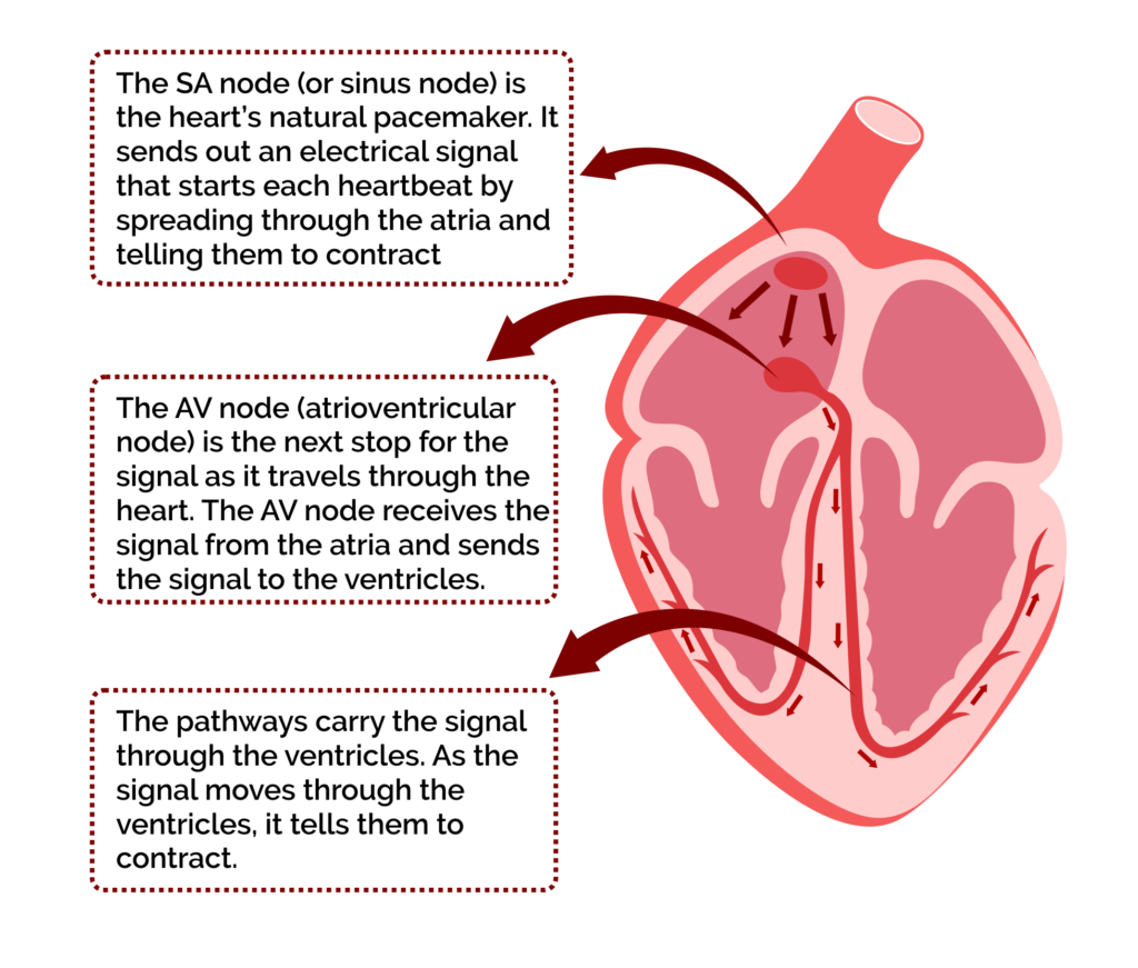 Electrophysiology Study and Radiofrequency Ablation Procedure