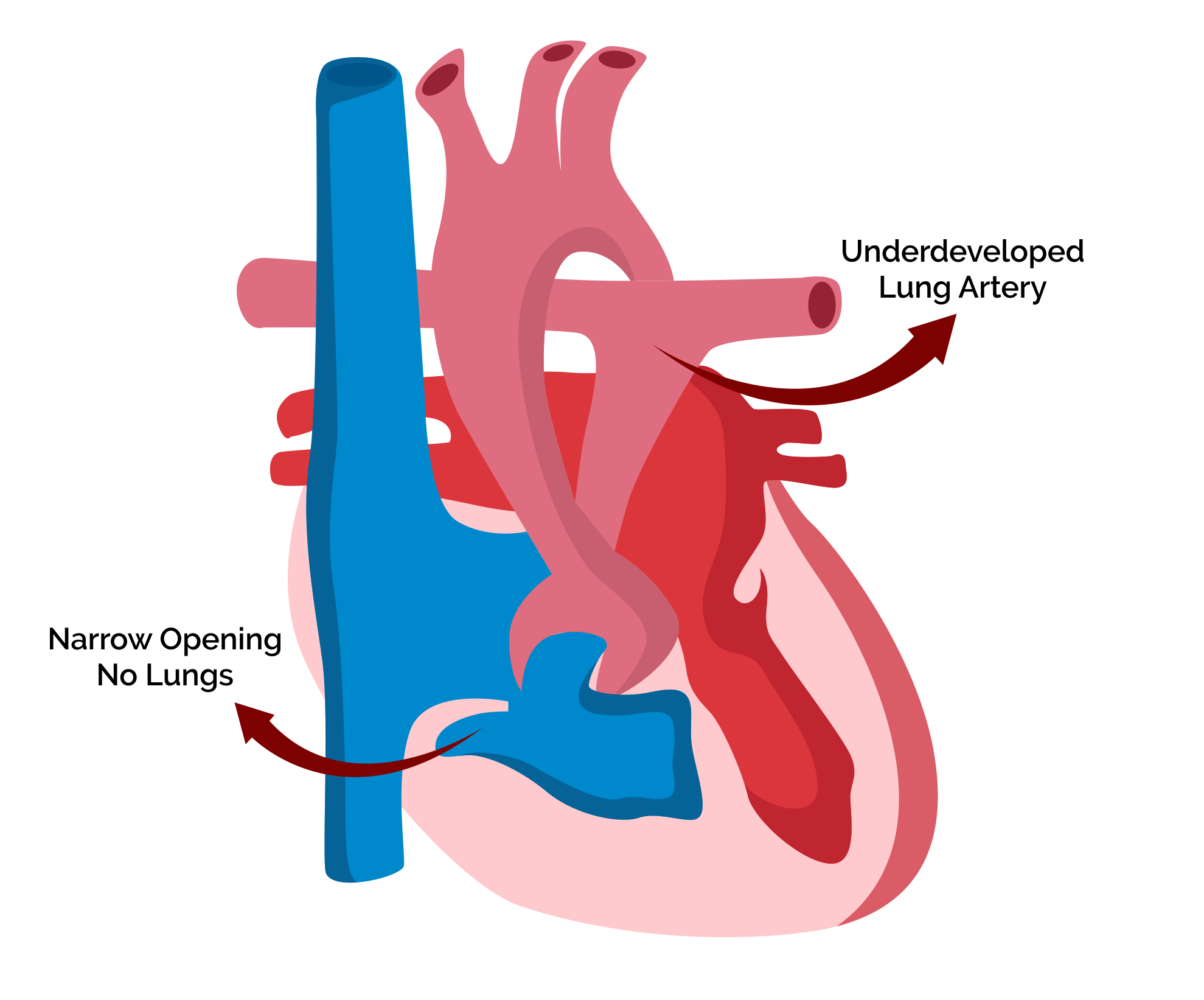 Paediatric Cardiology - Treatians